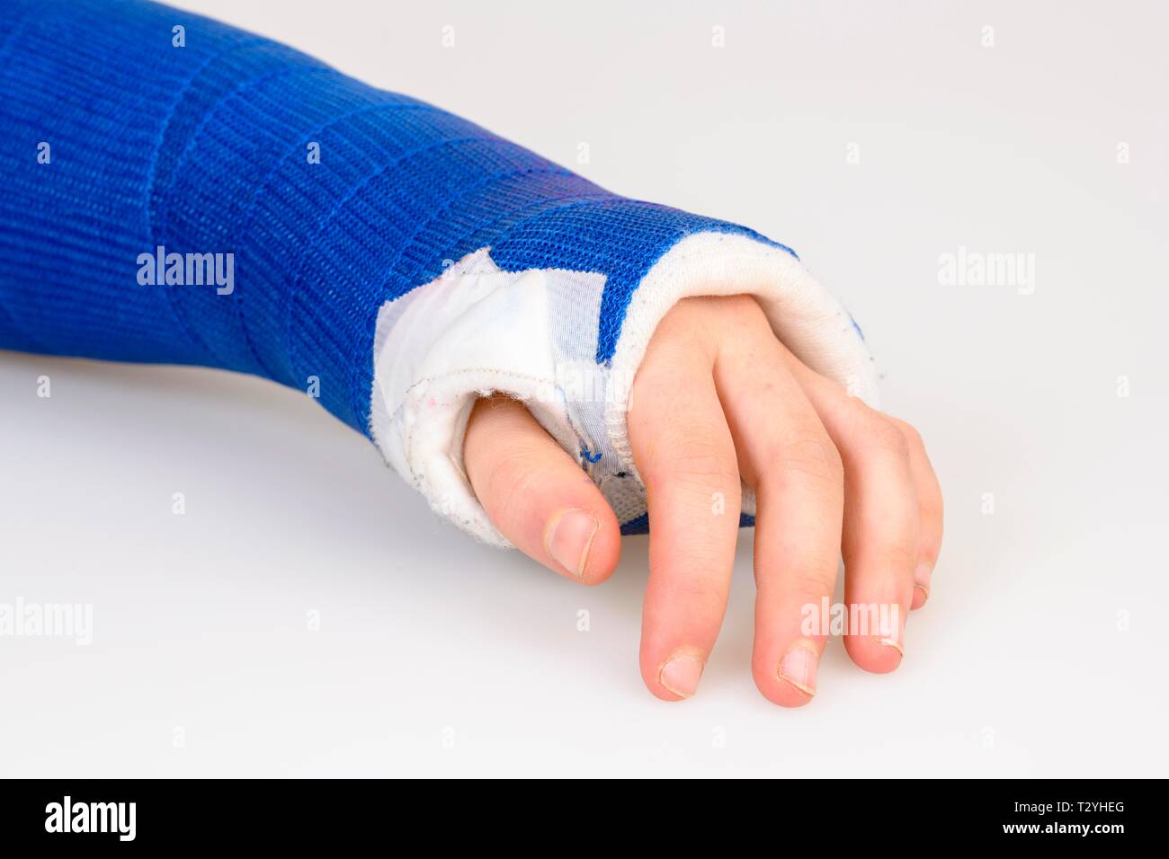 Handgelenk verputzen -Fotos und -Bildmaterial in hoher Auflösung – Alamy