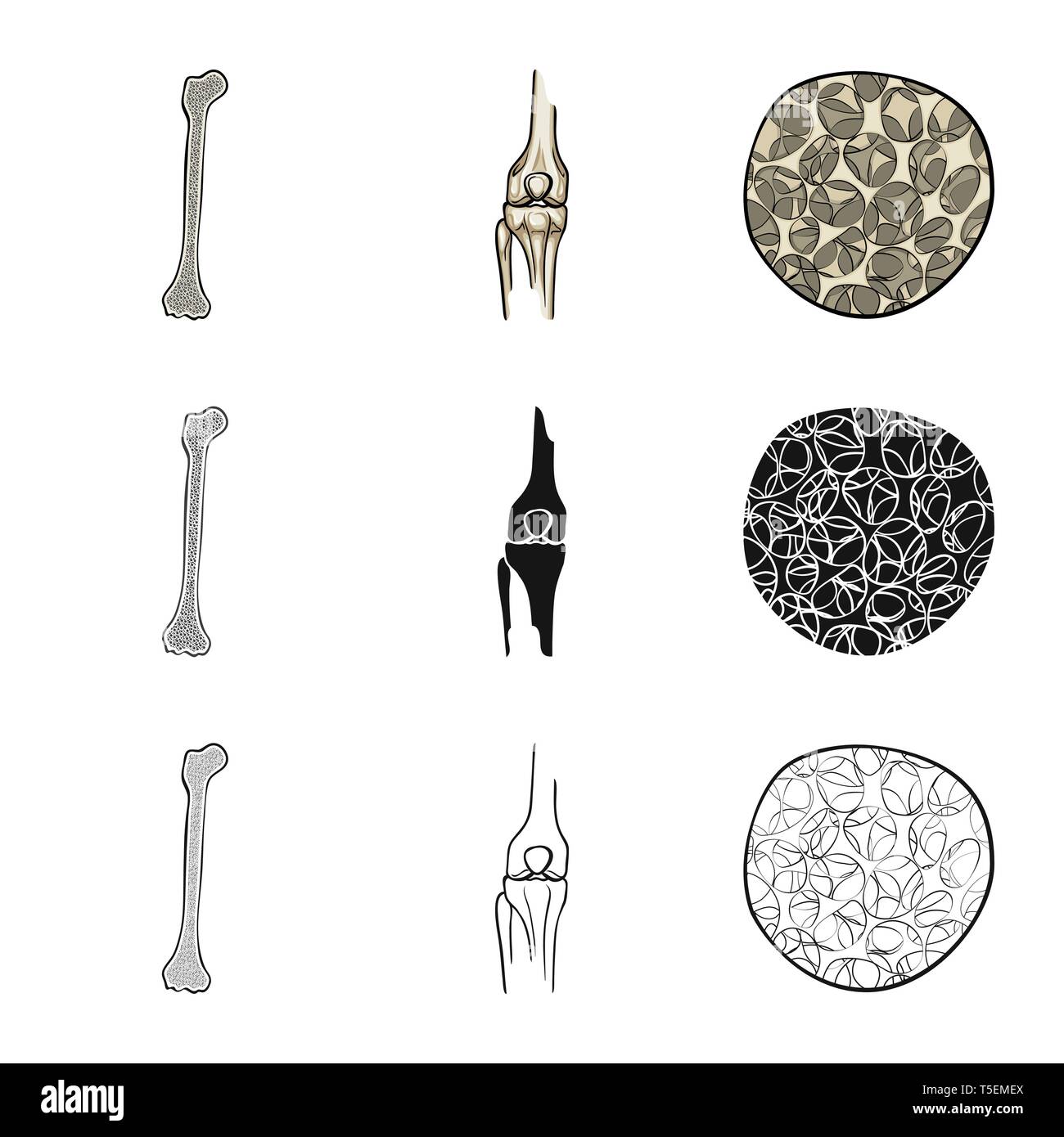 Femur, Osteoporose, Bony, Zelle, Gewebe, Bein, Knie, Bindegewebe ...