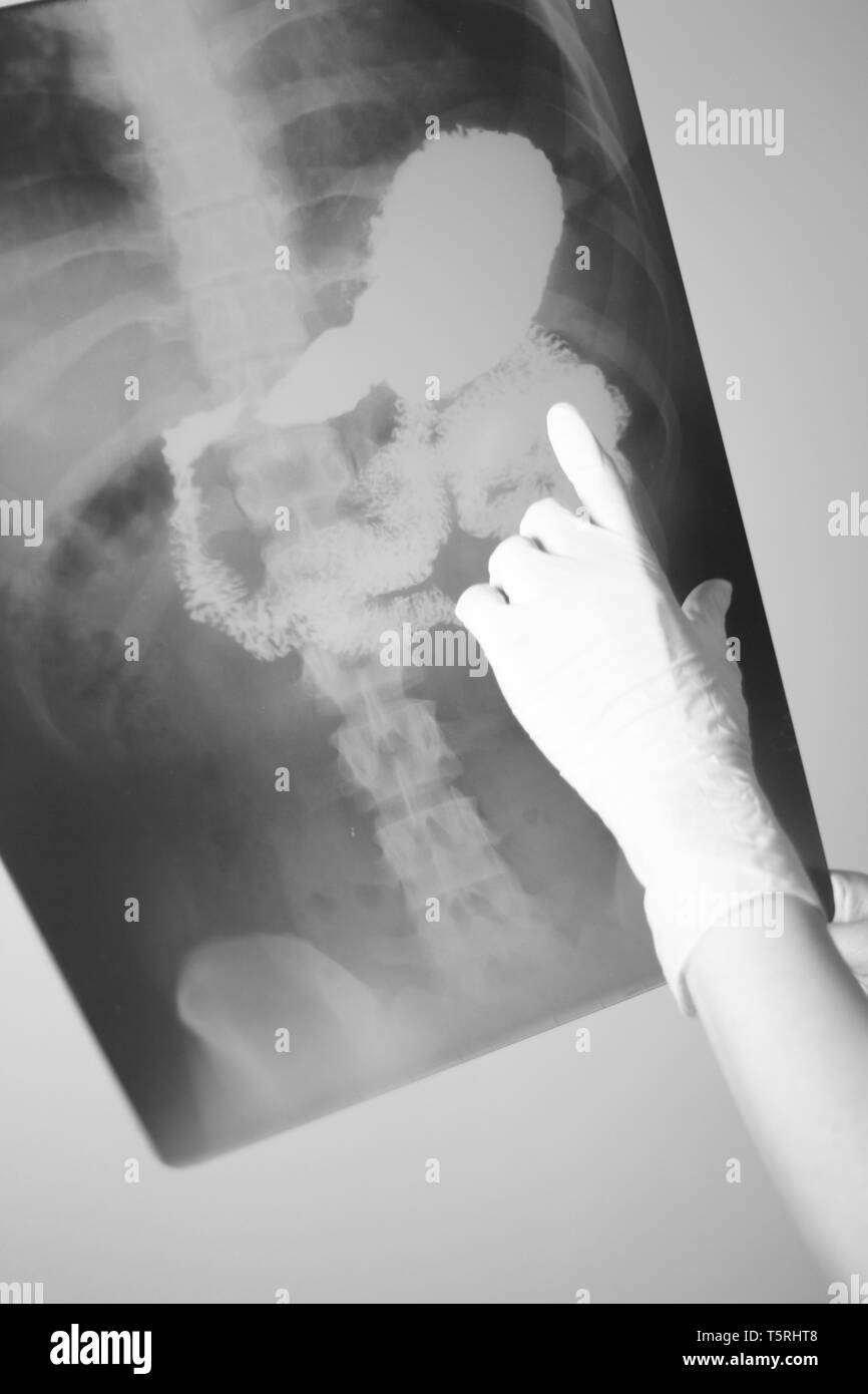 Medizinische Klinik x-ray Lowe Rückenschmerzen Wirbelsäule und Hüfte ...
