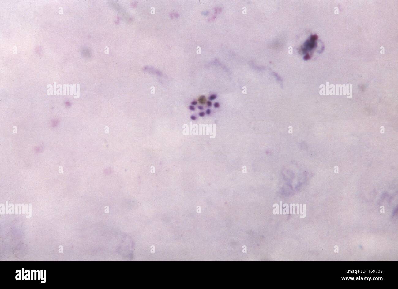 Malaria merozoiten -Fotos und -Bildmaterial in hoher Auflösung – Alamy