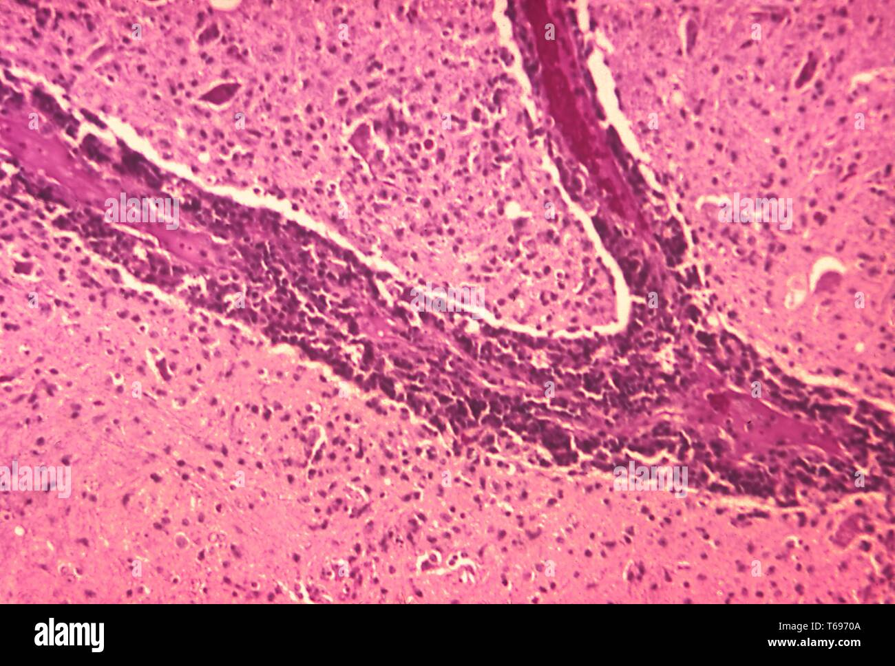 Dr daniel p perl -Fotos und -Bildmaterial in hoher Auflösung – Alamy