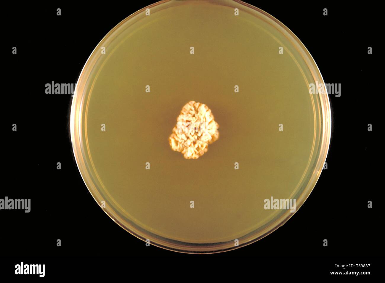 Nahaufnahme der Dermatophyte Test Medium (DTM) Agarplatte Kultur wächst ...