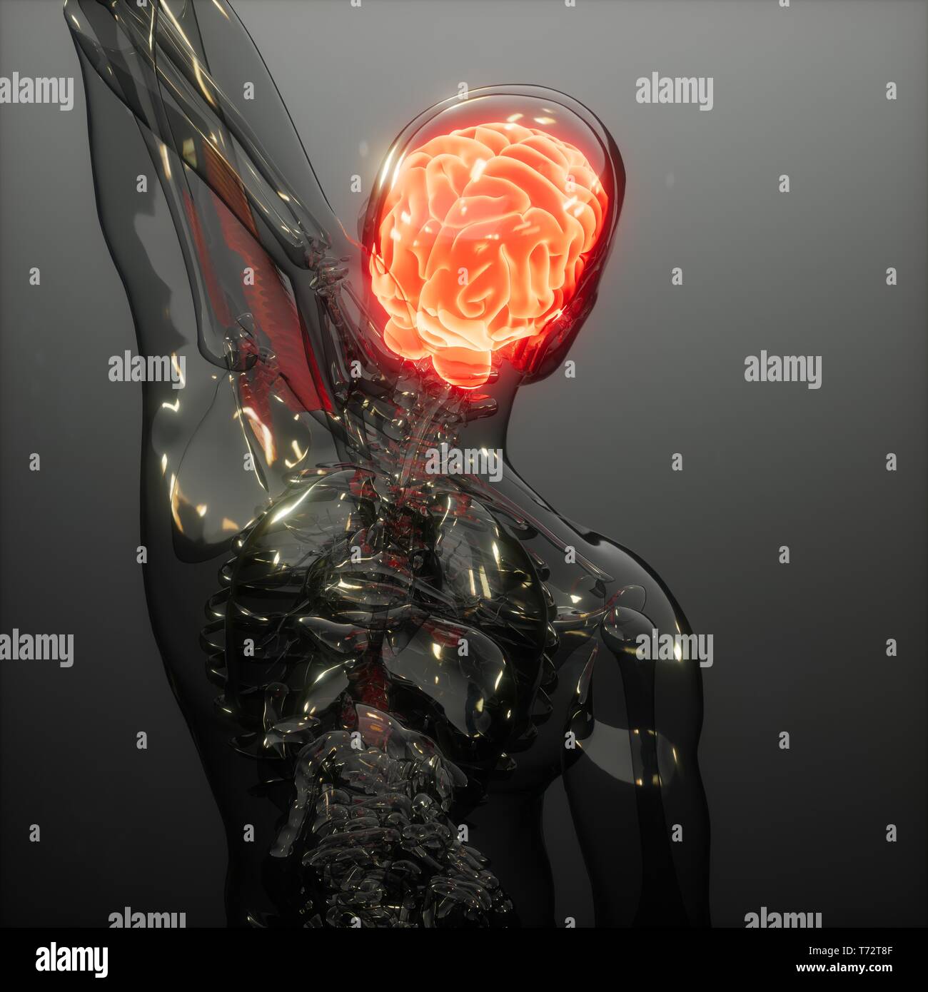 Ct scan gehirn gesund -Fotos und -Bildmaterial in hoher Auflösung - Seite 2 - Alamy