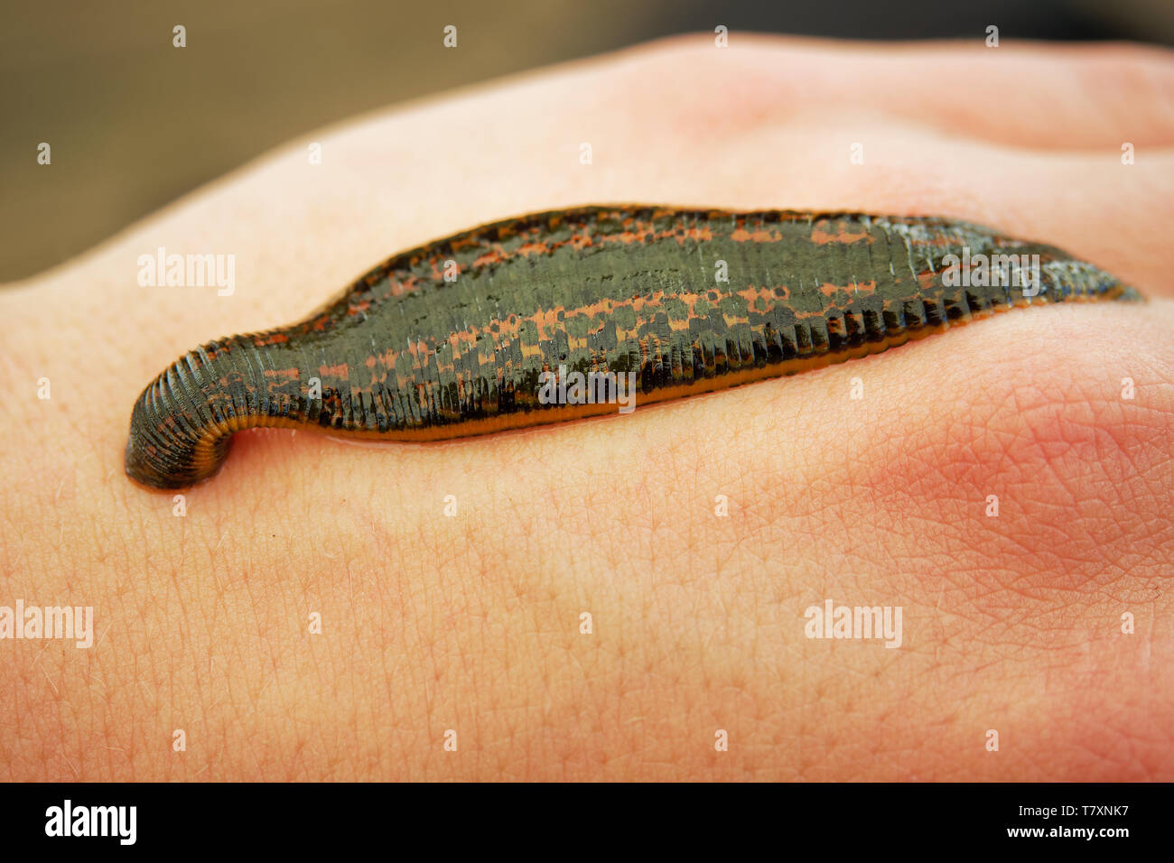 Medizinische Blutegel - Hirudo medicinalis - Blutegel beißen, Leech ist ...