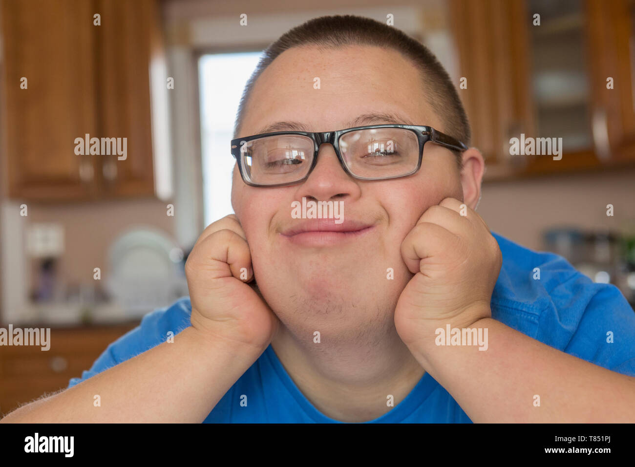Down syndrome -Fotos und -Bildmaterial in hoher Auflösung – Alamy