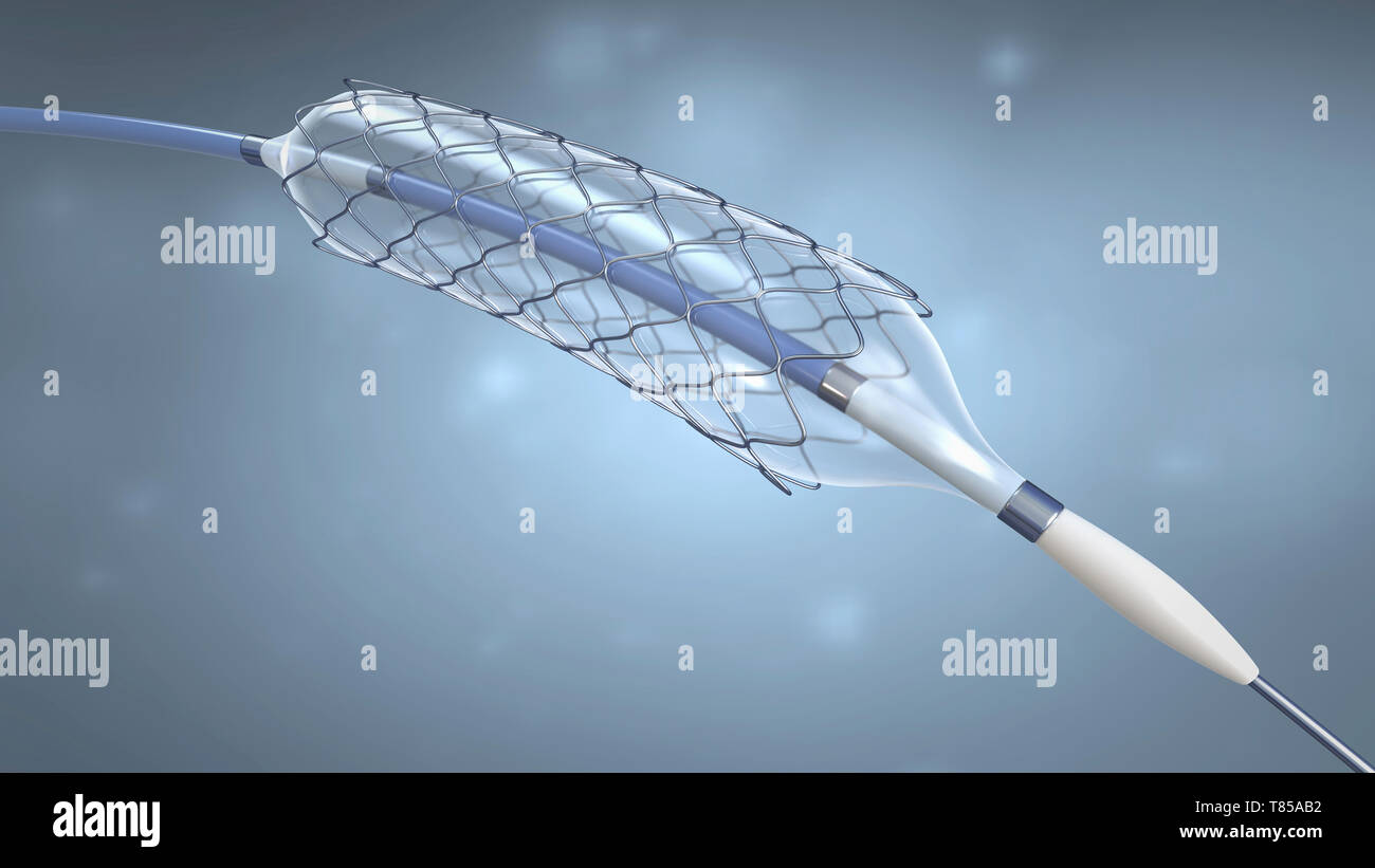 Coronary stent -Fotos und -Bildmaterial in hoher Auflösung – Alamy