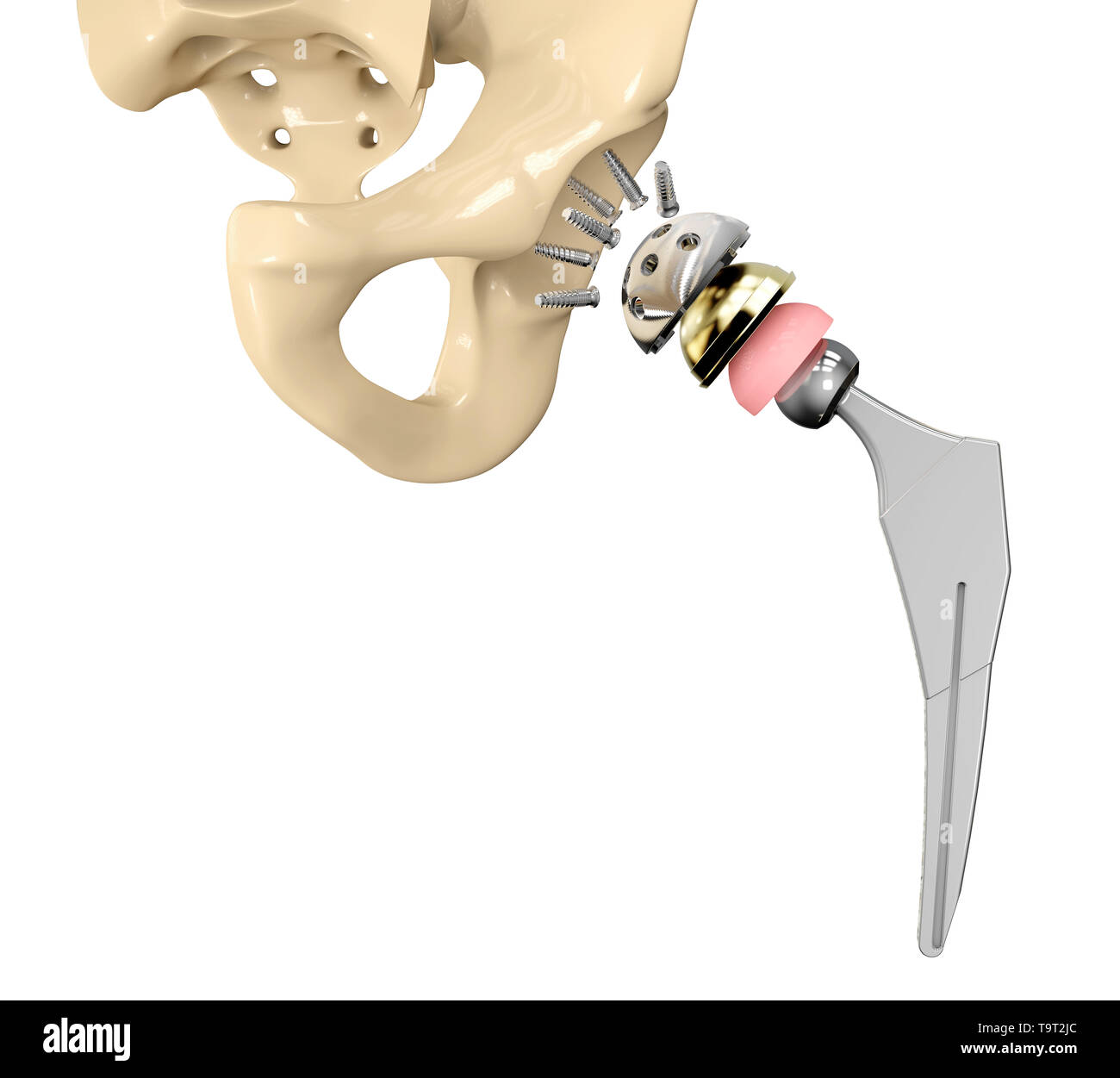 3d render illustration pelvis bone -Fotos und -Bildmaterial in hoher ...