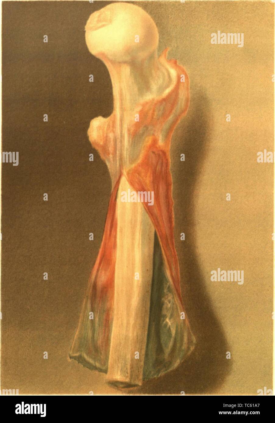 Gravur der periosttrennung -Fotos und -Bildmaterial in hoher Auflösung ...