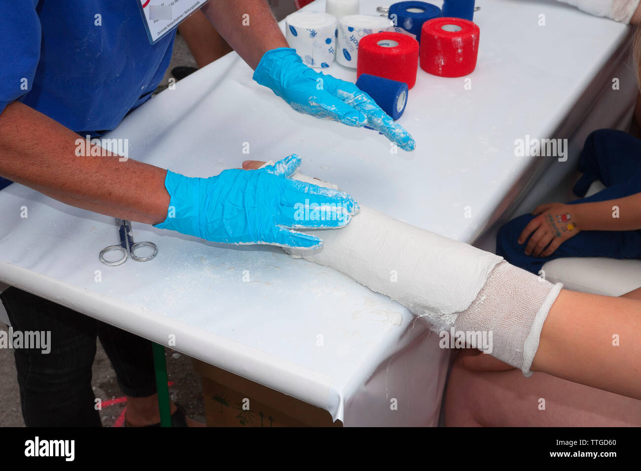 Plaster Cast Arm Stockfotos und -bilder Kaufen - Alamy
