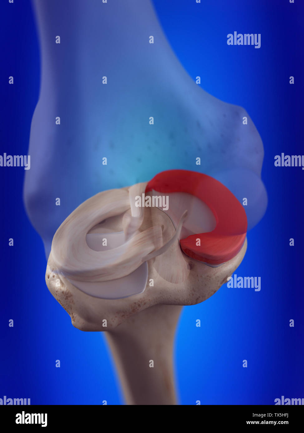 Medialer meniskus -Fotos und -Bildmaterial in hoher Auflösung – Alamy