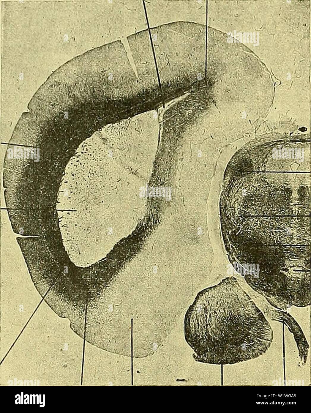 Substantia nigra -Fotos und -Bildmaterial in hoher Auflösung – Alamy
