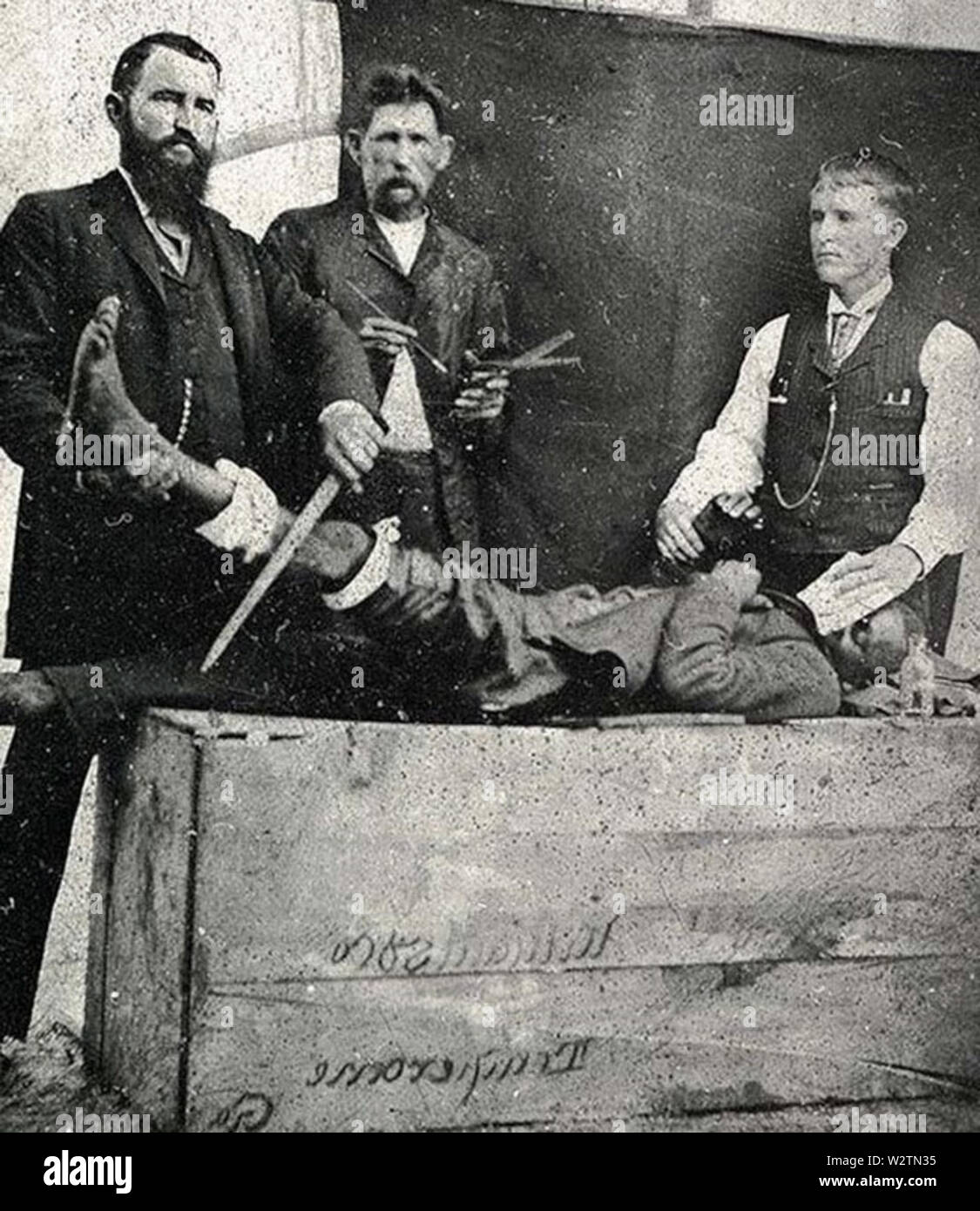 Chirurgia di amputazione -Fotos und -Bildmaterial in hoher Auflösung ...