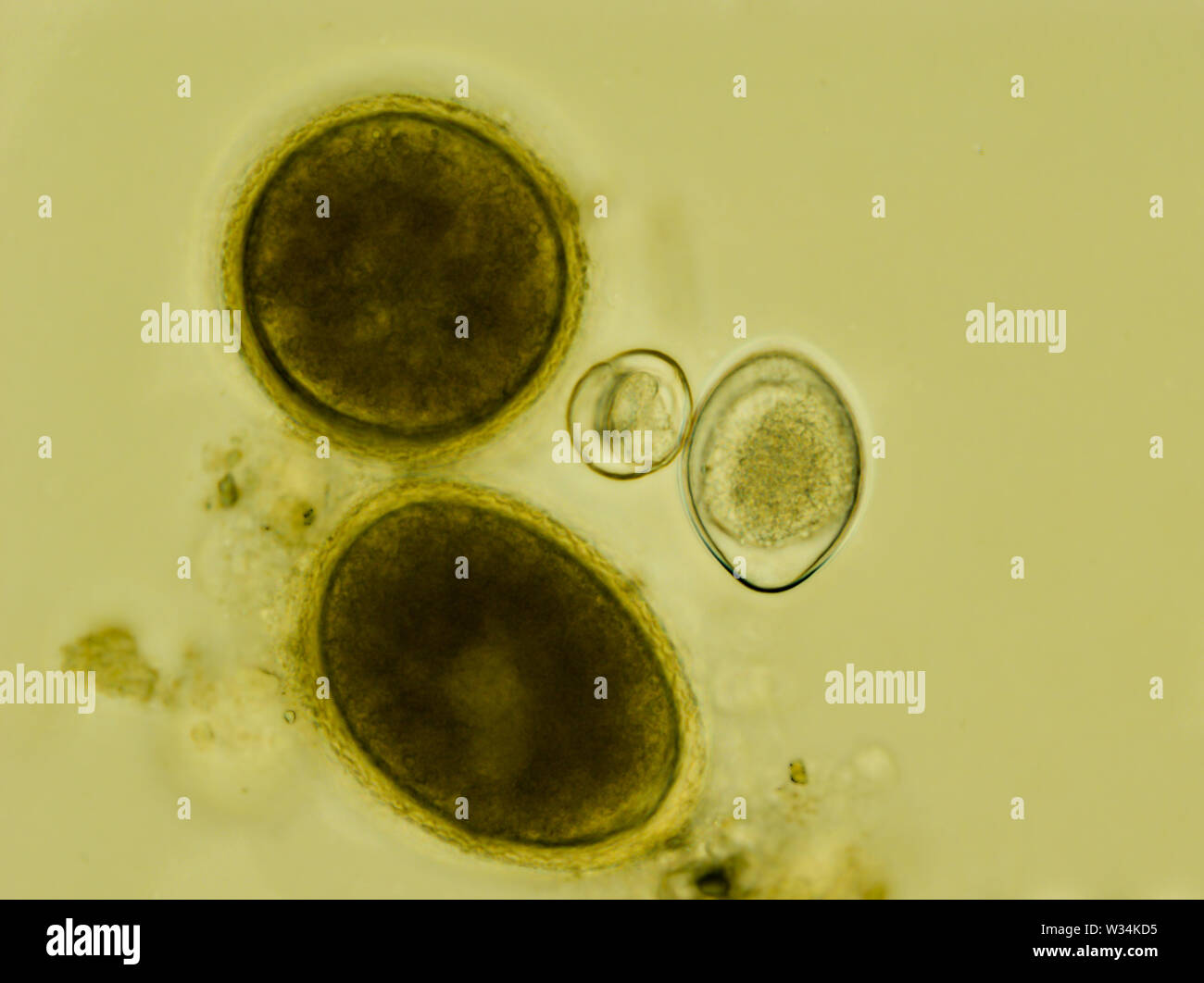Zwei Eier von Toxocara Cati und zwei oocysts der Isospora felis unter ...