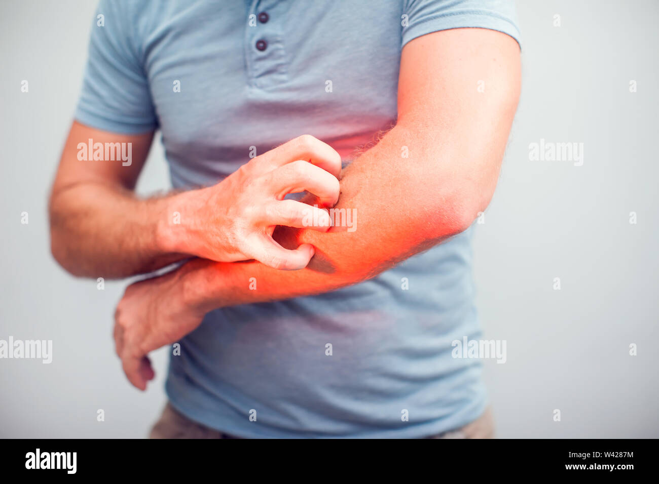 Scratch an itch -Fotos und -Bildmaterial in hoher Auflösung – Alamy