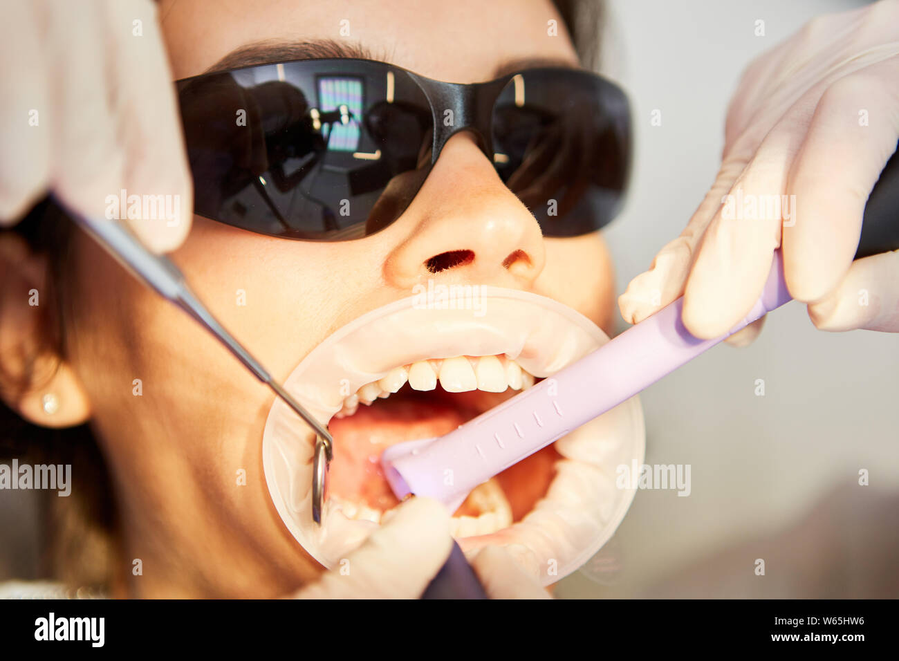 Wide open mouth doctor -Fotos und -Bildmaterial in hoher Auflösung – Alamy