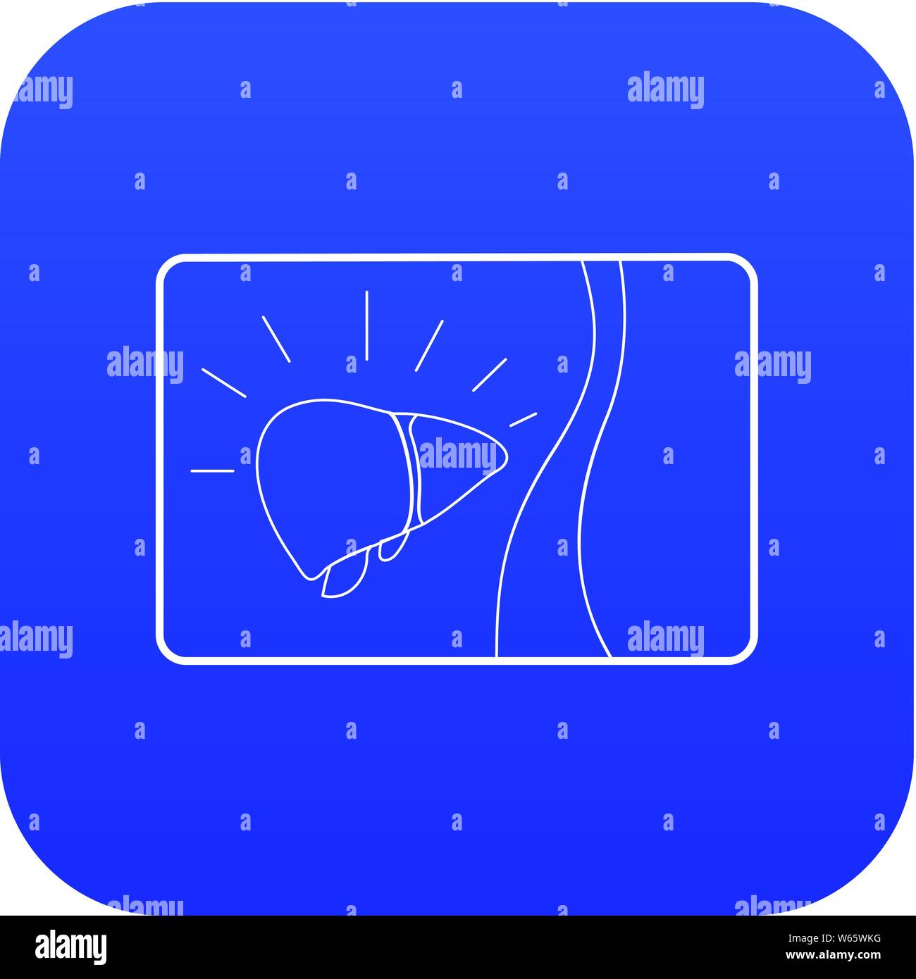 Liver cirrhosis drawing Stock-Vektorgrafiken kaufen - Seite 2 - Alamy