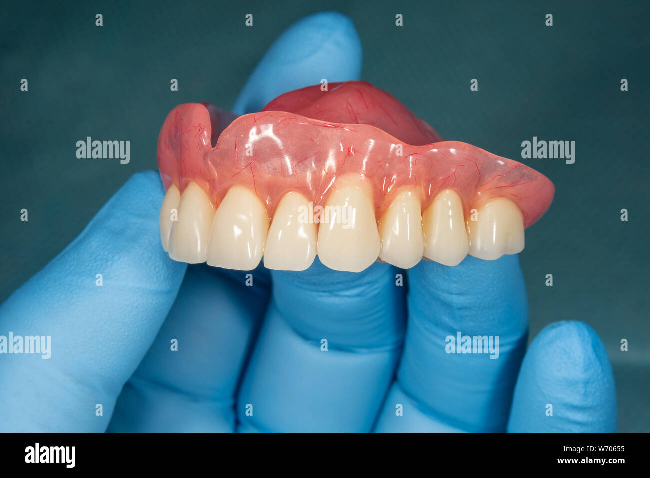 Herausnehmbare Teilprothese Stockfotos und -bilder Kaufen - Alamy