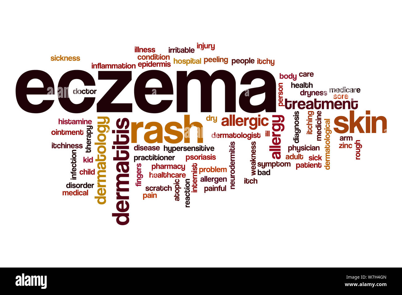 Eczema atopic dermatitis symptom skin Ausgeschnittene Stockfotos und ...