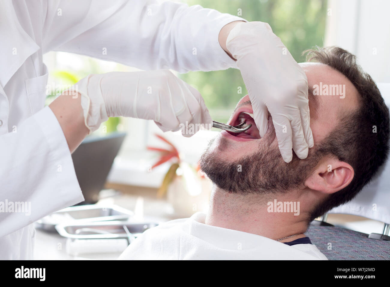Teeth extraction -Fotos und -Bildmaterial in hoher Auflösung – Alamy