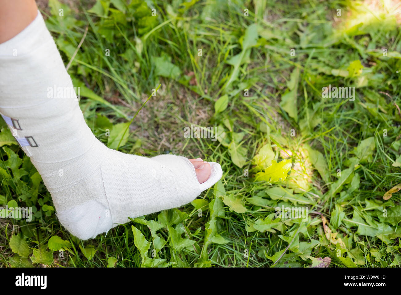 Junge frau mit gips bein -Fotos und -Bildmaterial in hoher Auflösung ...