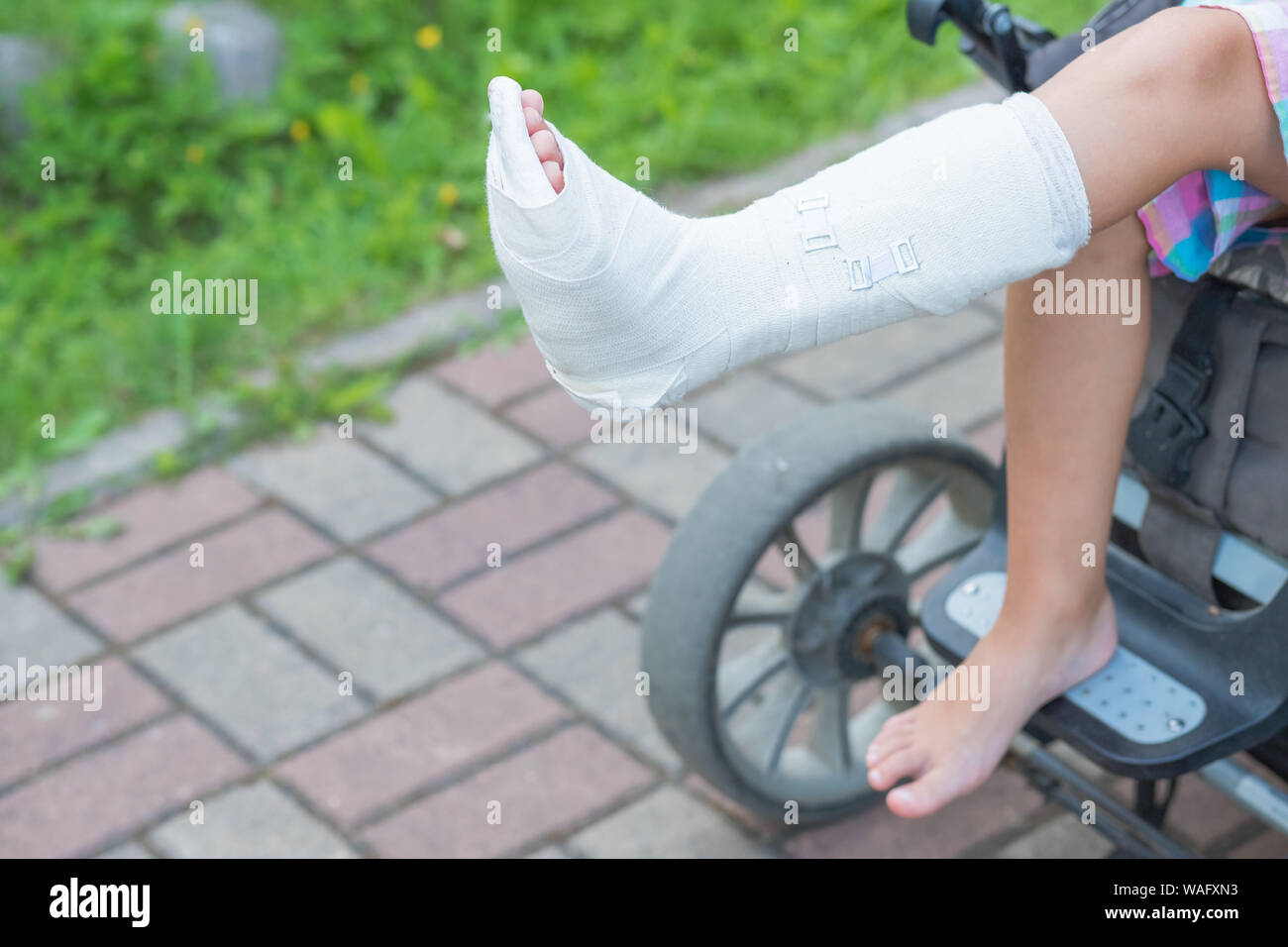 Gips bein gebrochen frau krankenhaus -Fotos und -Bildmaterial in hoher ...