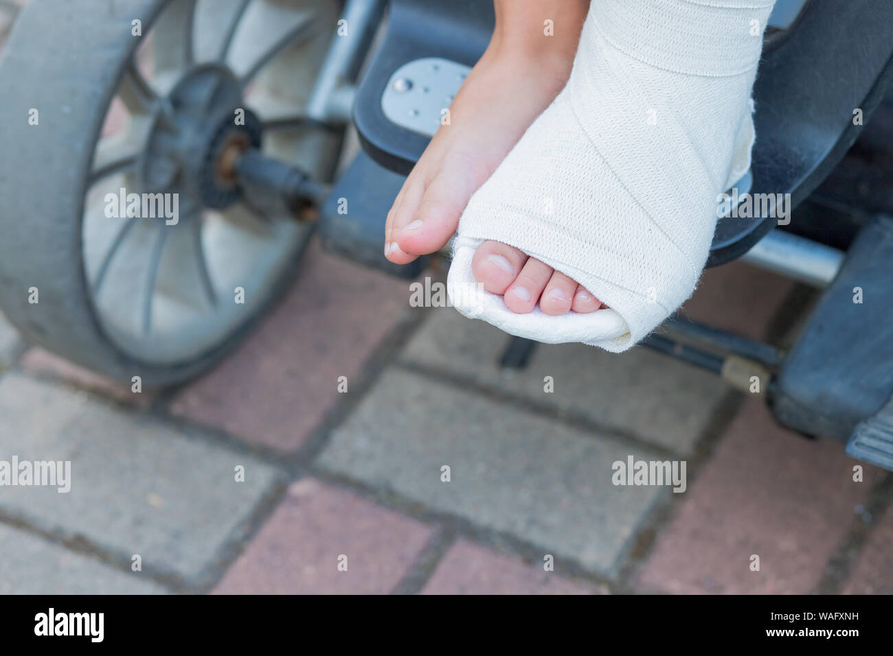 Gips bein gebrochen frau krankenhaus -Fotos und -Bildmaterial in hoher ...
