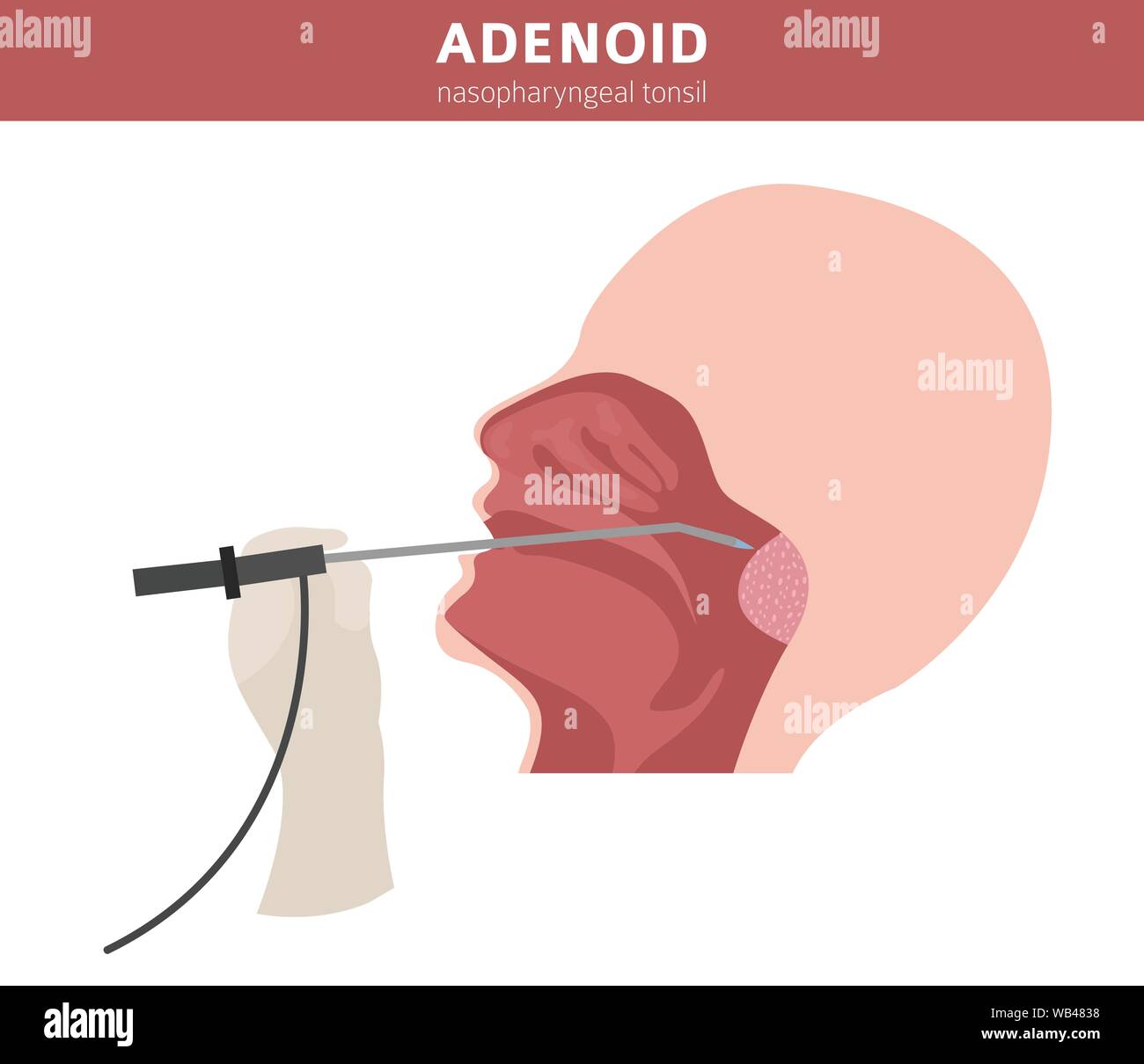 Menschlicher naso pharynx -Fotos und -Bildmaterial in hoher Auflösung ...