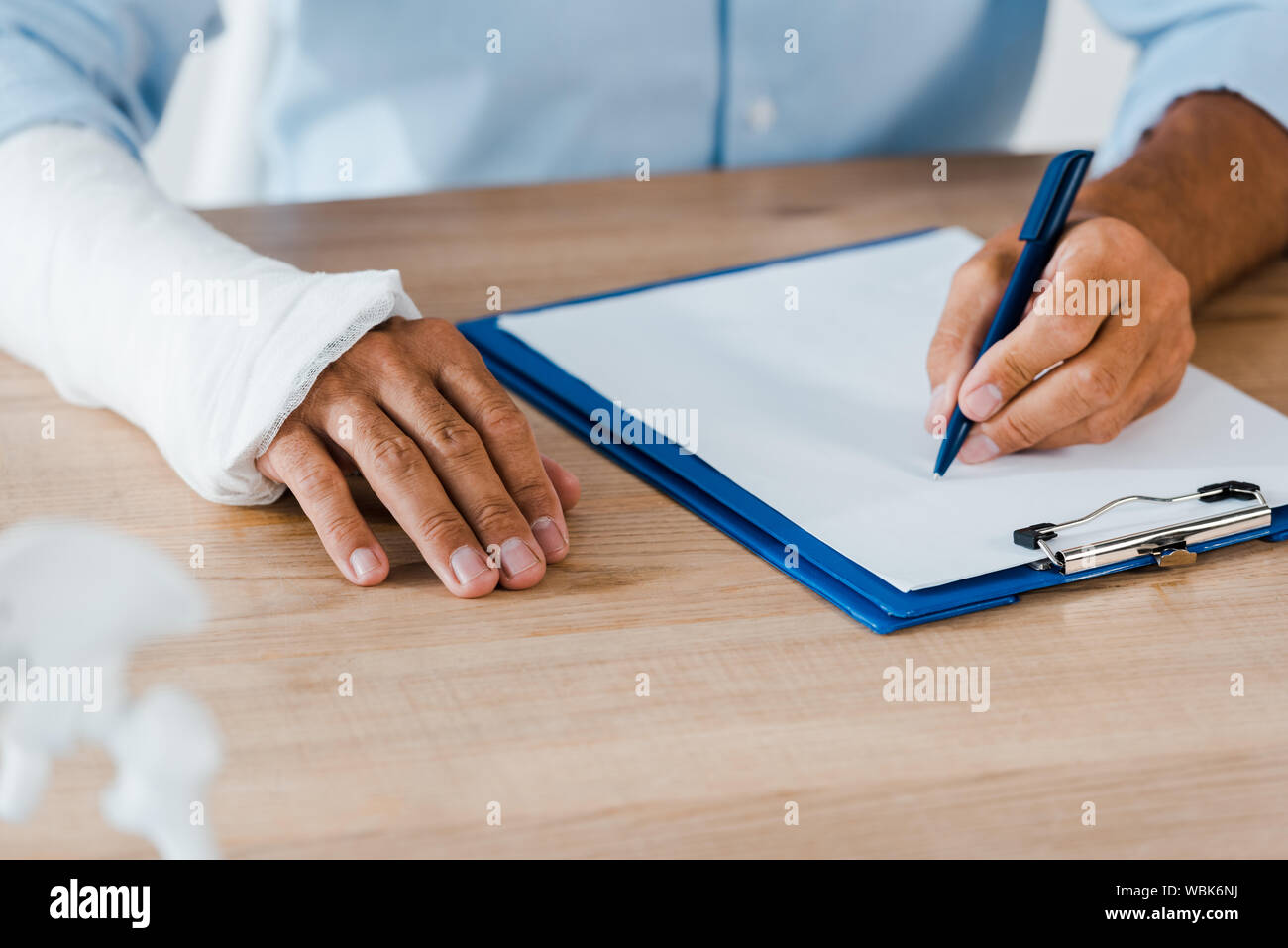 7/8-Ansicht von verletzten Mann mit Gips Verband schriftlich über die ...