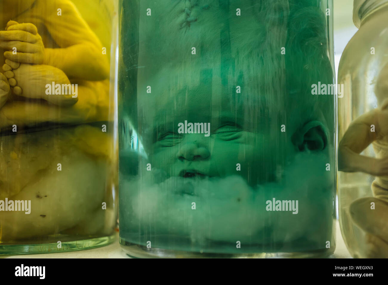 Fötus formalin Stockfotos und -bilder Kaufen - Alamy