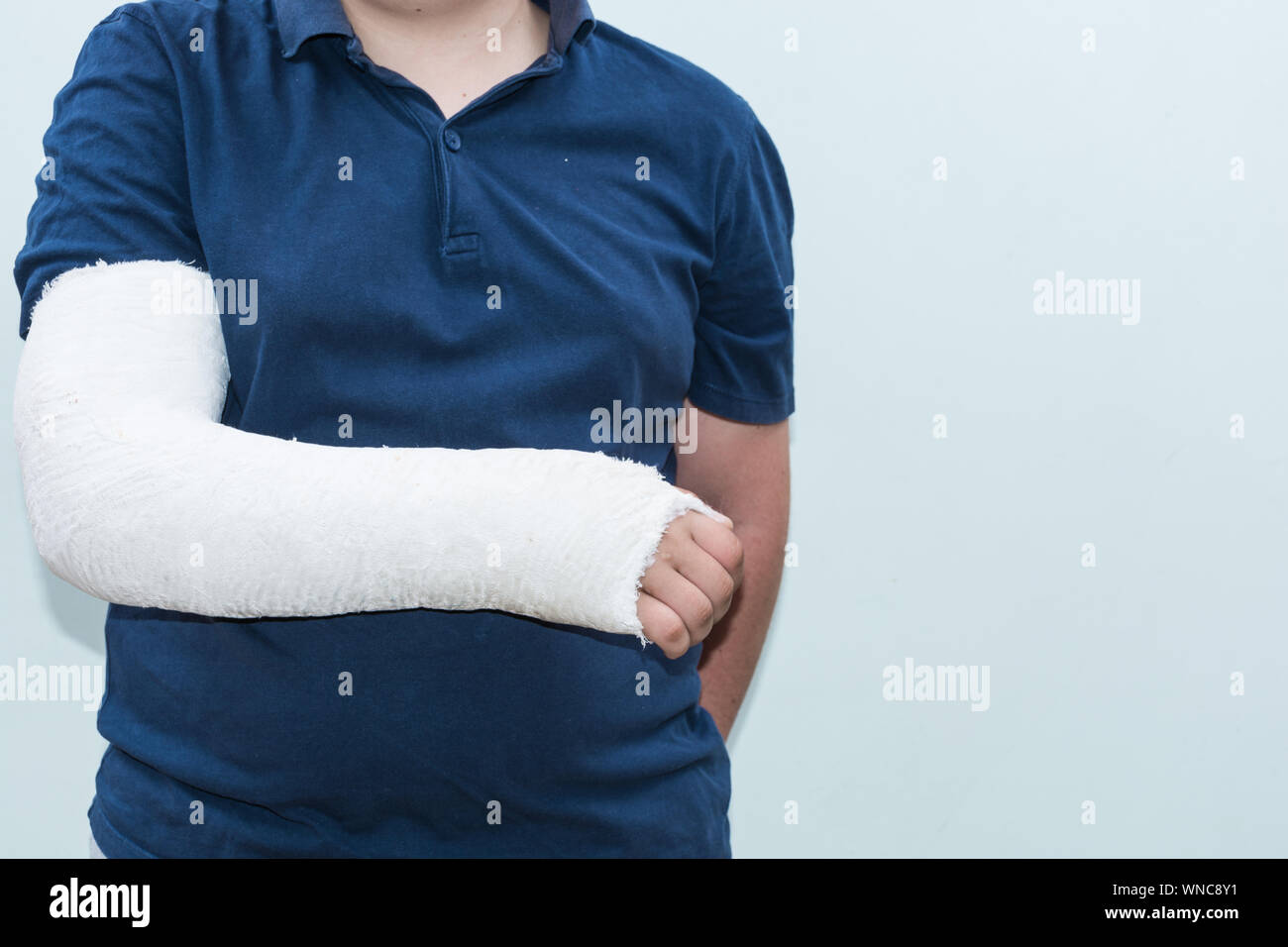 Gebrochener arm -Fotos und -Bildmaterial in hoher Auflösung – Alamy