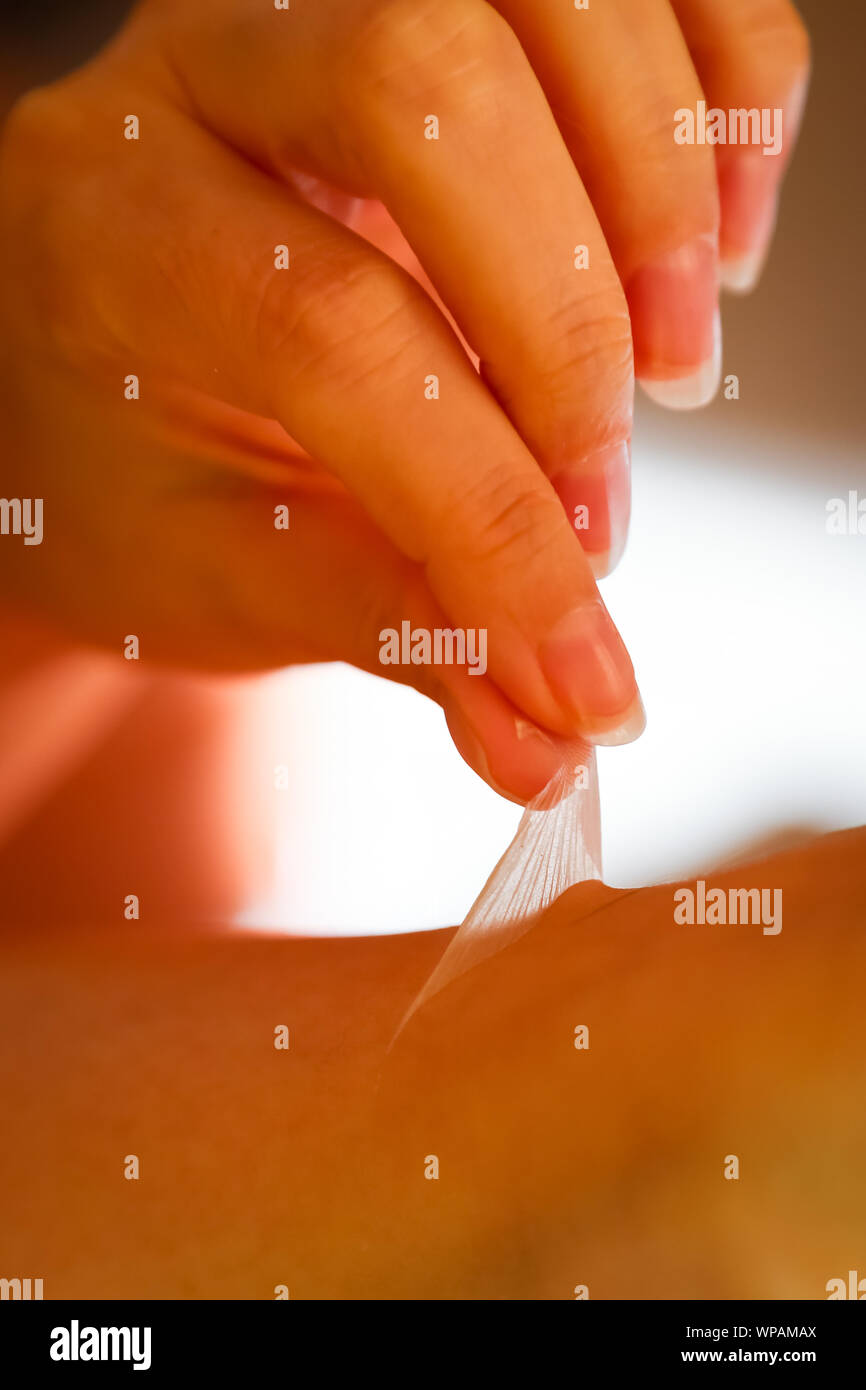 Verbrannter arm -Fotos und -Bildmaterial in hoher Auflösung – Alamy
