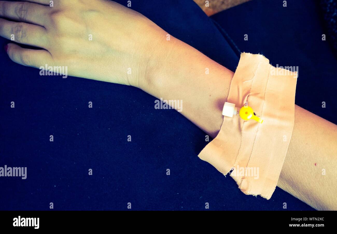 Katheter Mit Stockfotos und -bilder Kaufen - Alamy