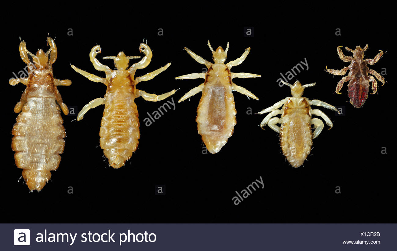 Weibliche Kopflaus Stockfotos und -bilder Kaufen - Alamy