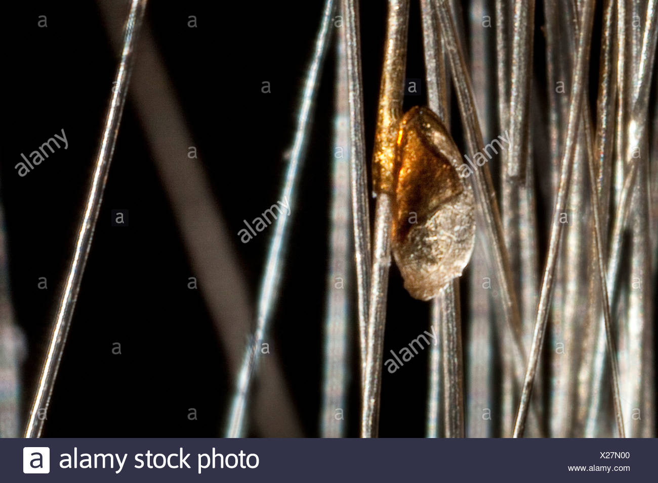 Kopflaus Pediculus Capitis Stockfotos und -bilder Kaufen - Alamy