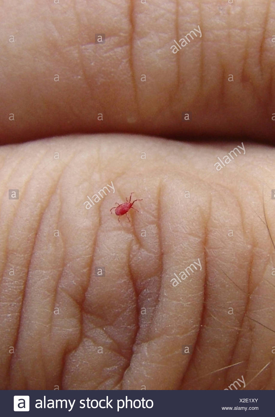 Trombicula Autumnalis Stockfotos und -bilder Kaufen - Alamy