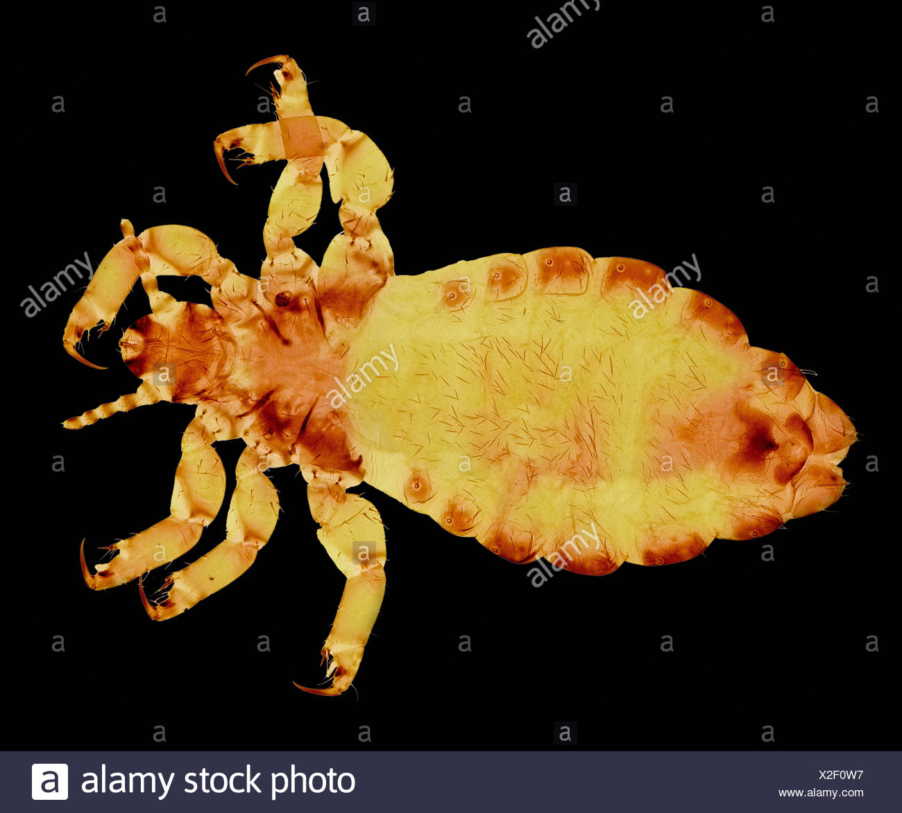 Kopflaus Pediculus Capitis Stockfotos und -bilder Kaufen - Alamy