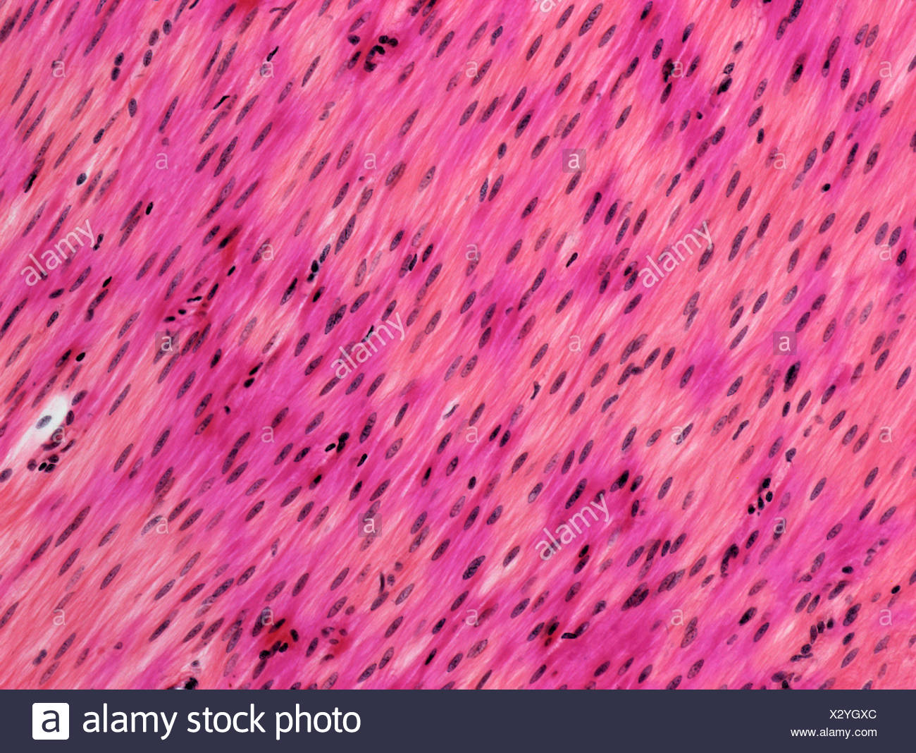 Smooth Muscle Cell Stockfotos und -bilder Kaufen - Alamy