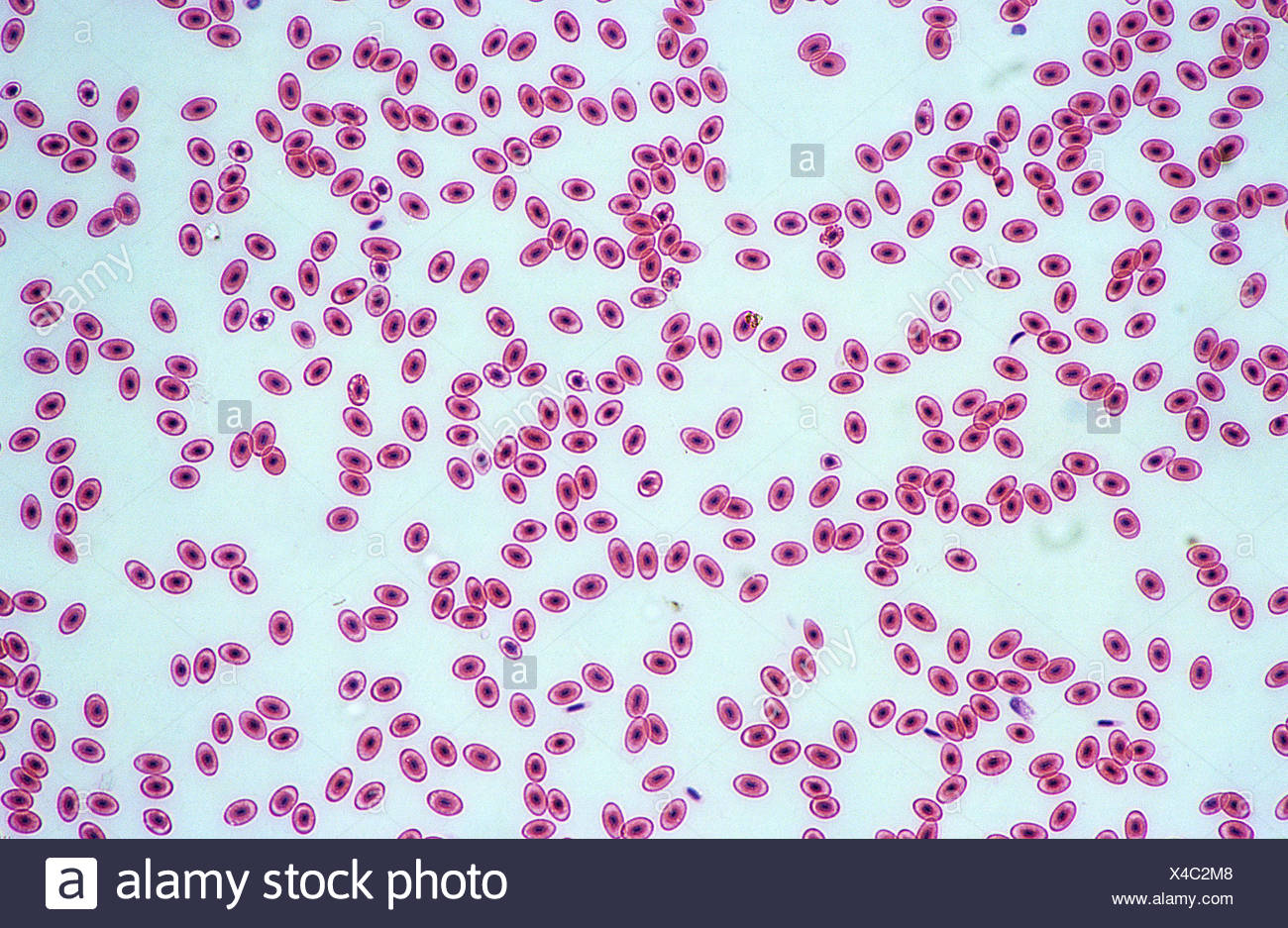 Smear Blood Stockfotos und -bilder Kaufen - Alamy