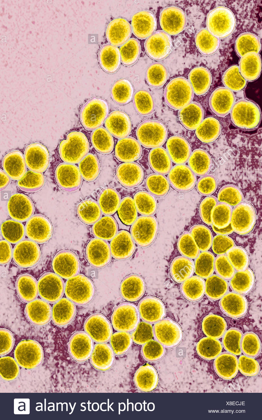 Staphylokokken Infektion Stockfotos und -bilder Kaufen - Alamy