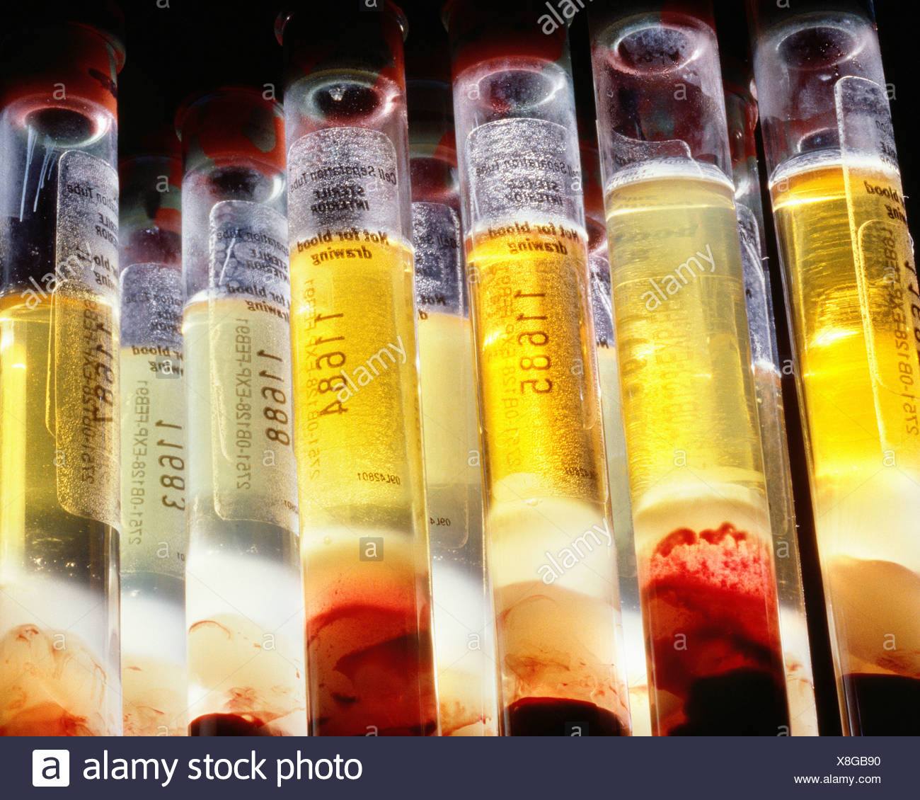 Blutserum Röhrchen Stockfotos & Blutserum Röhrchen Bilder - Alamy