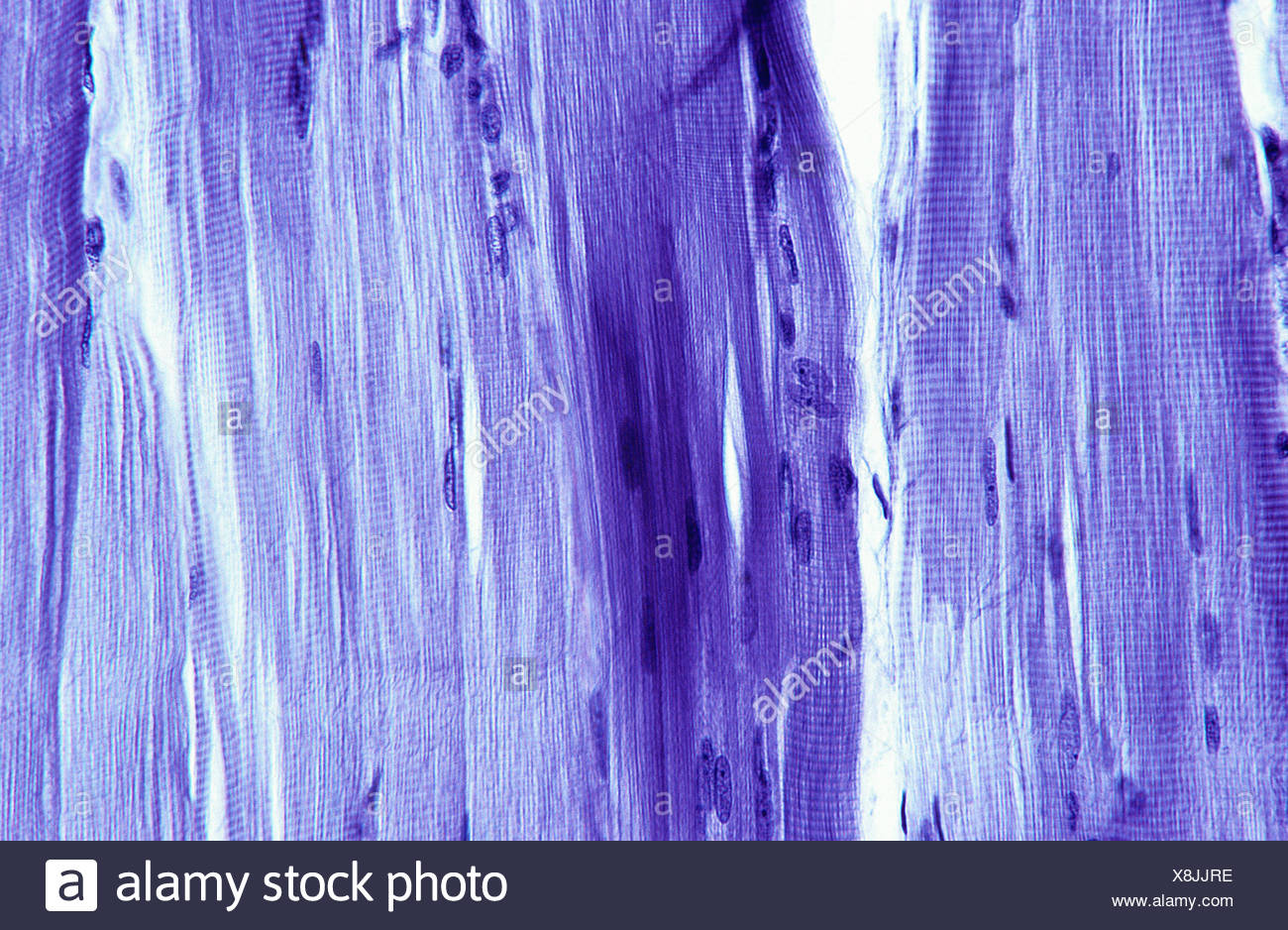 Quergestreiftes Muskelgewebe Stockfotos und -bilder Kaufen - Alamy