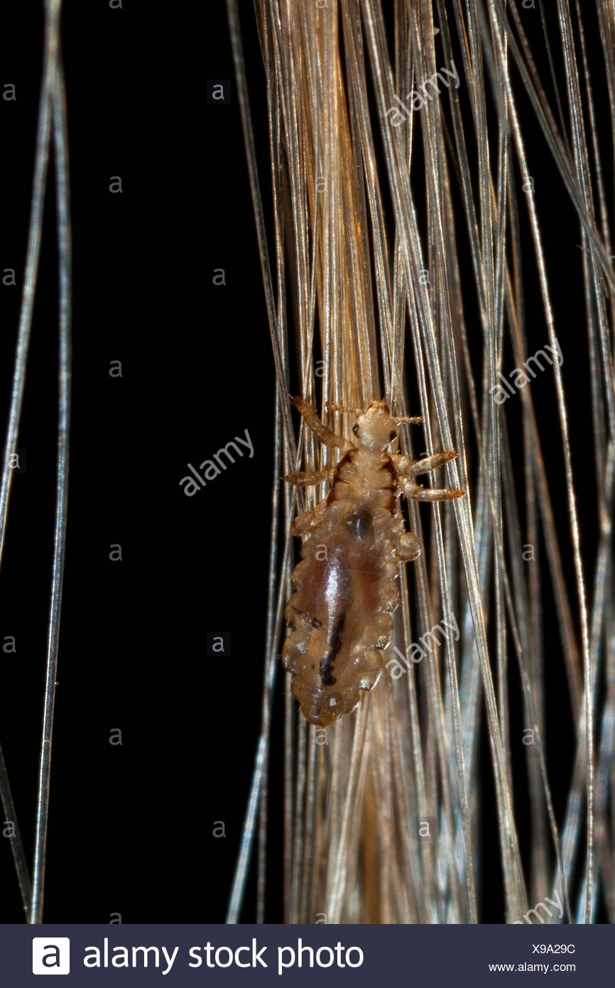Kopflaus Pediculus Capitis Stockfotos und -bilder Kaufen - Alamy