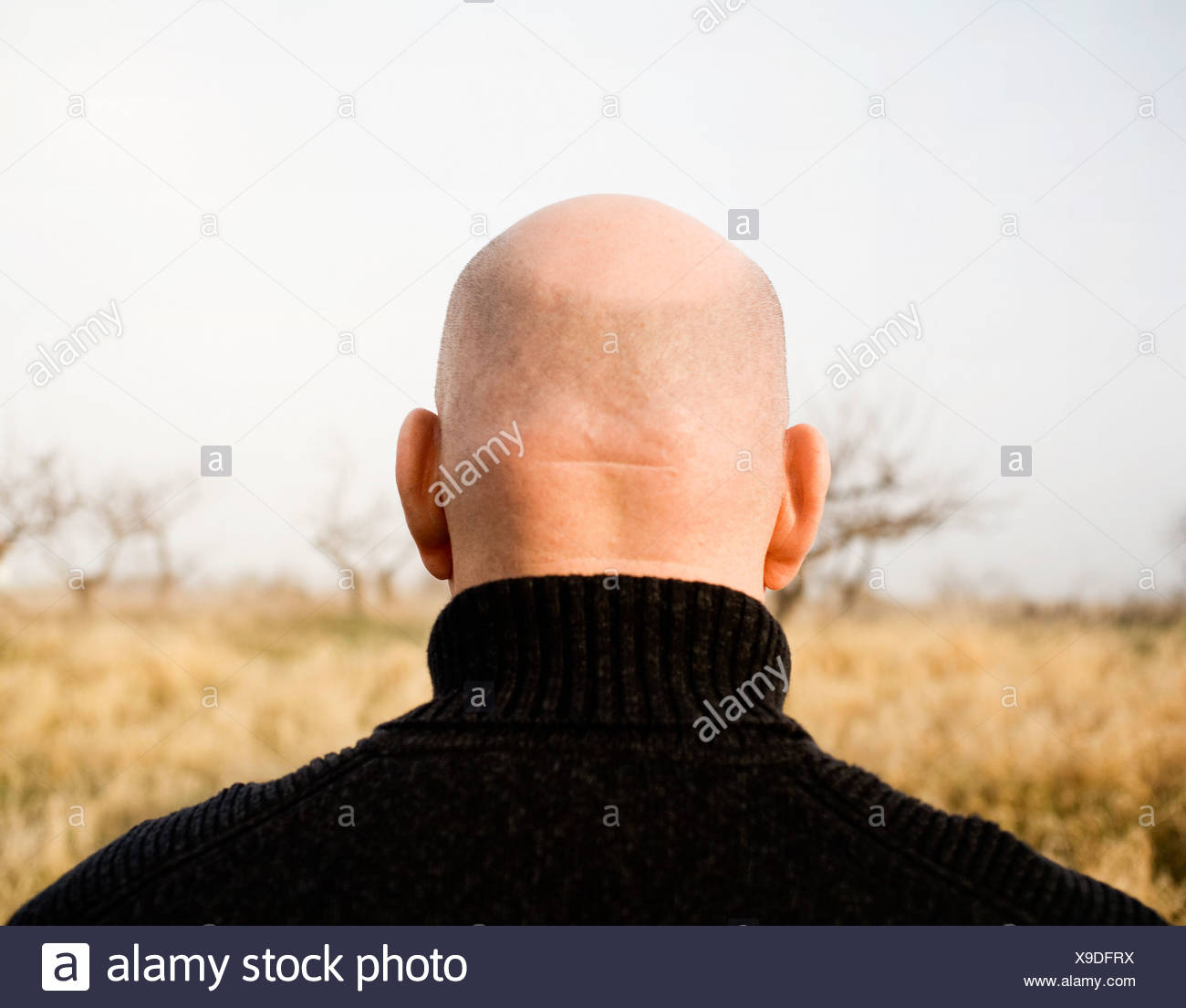 Die Glatze Stockfotos und -bilder Kaufen - Alamy