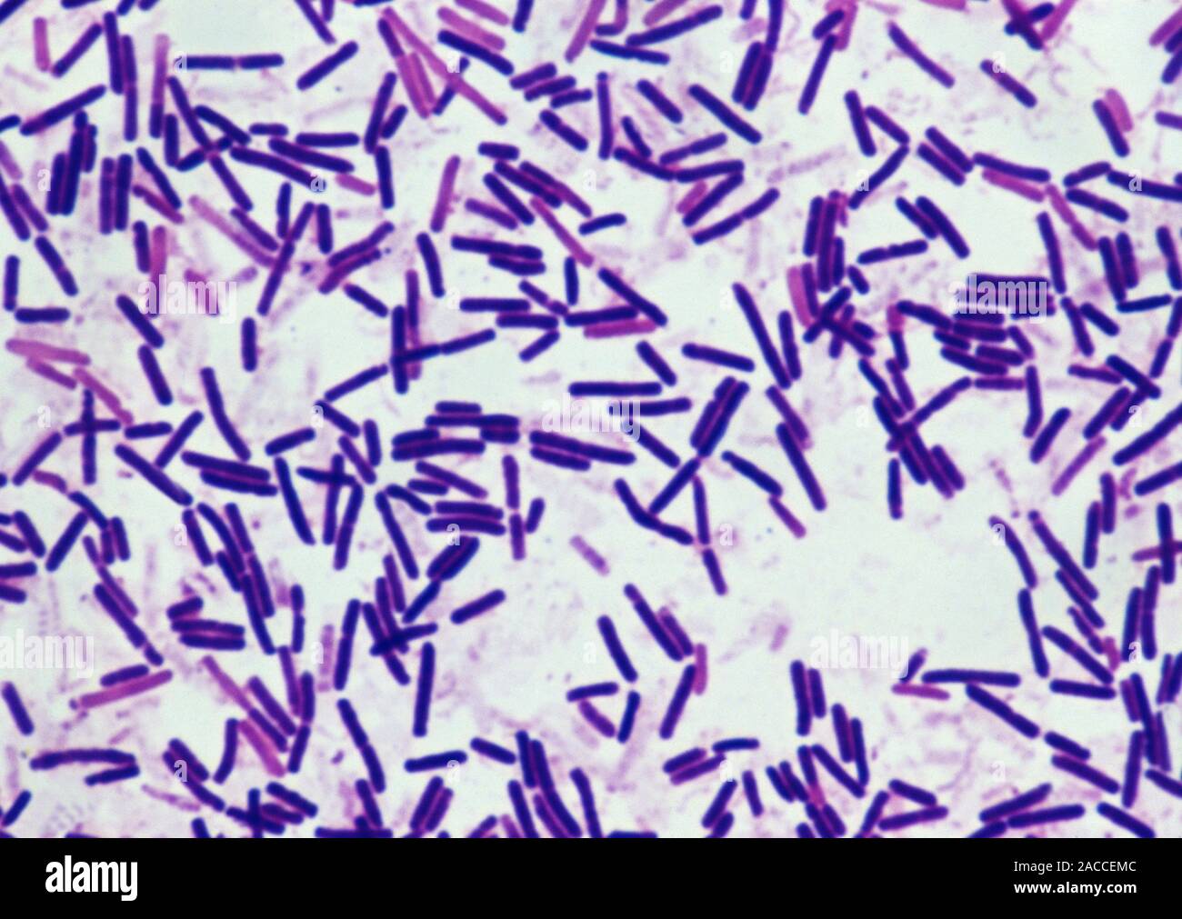 Bacterias Botulismo Micrografía De Luz De La Bacteria Del Botulismo