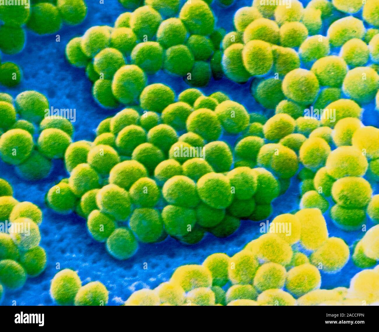 Falso Color Análisis Micrografía De Electrones Sem De Una Colonia De