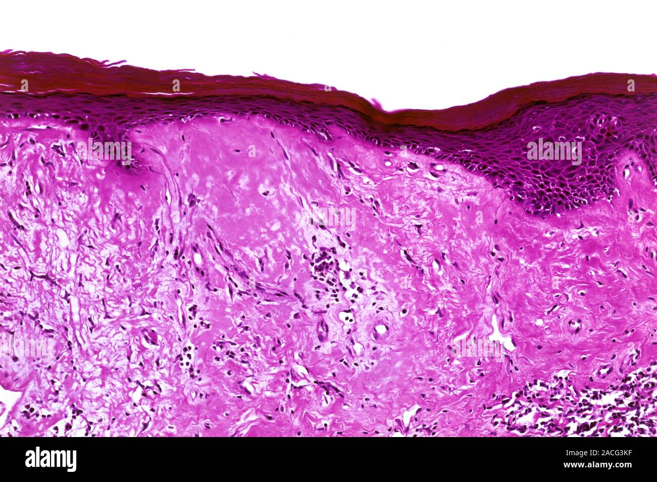 Líquen Escleroso é Perigoso - RETOEDU
