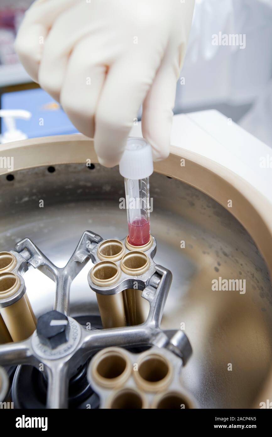 Banco De Esperma Trabajador De Laboratorio Colocando Una Muestra De