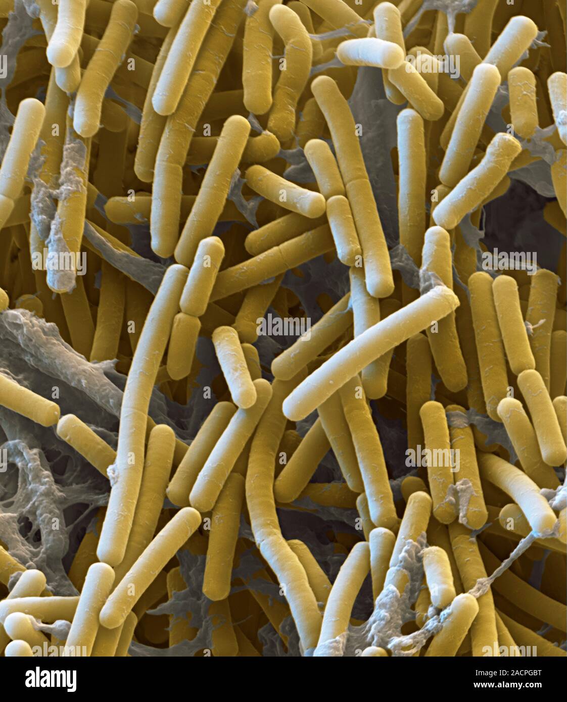 La Bacteria Clostridium Botulinum Color Análisis Micrografía De