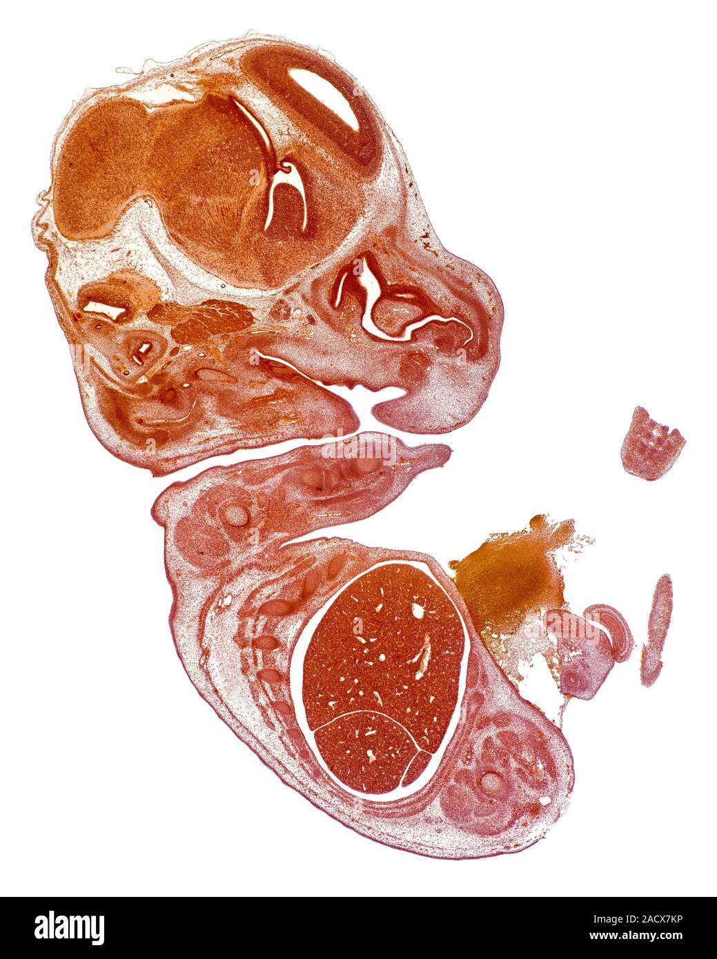 Embrión de ratón. Micrografía de luz de un ratón (Mus sp.), embrión de ...