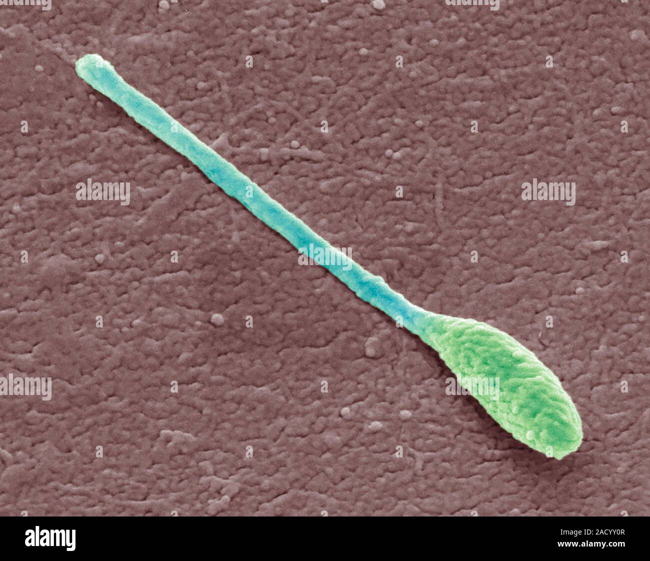 La Bacteria Clostridium Phytofermentans Color Análisis Micrografía De